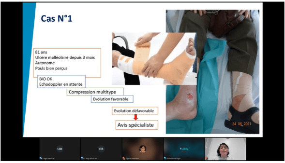 A look back at the Leg Ulcer and Compression Week ! - Fondation Urgo